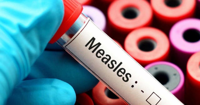 Measles outbreak: Los Angeles health officials investigate after 5 ...