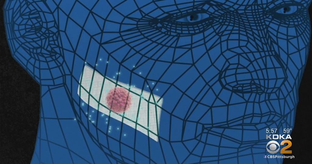 Researchers Create Patch That's Giving Oral Cancer Patients New Hope ...