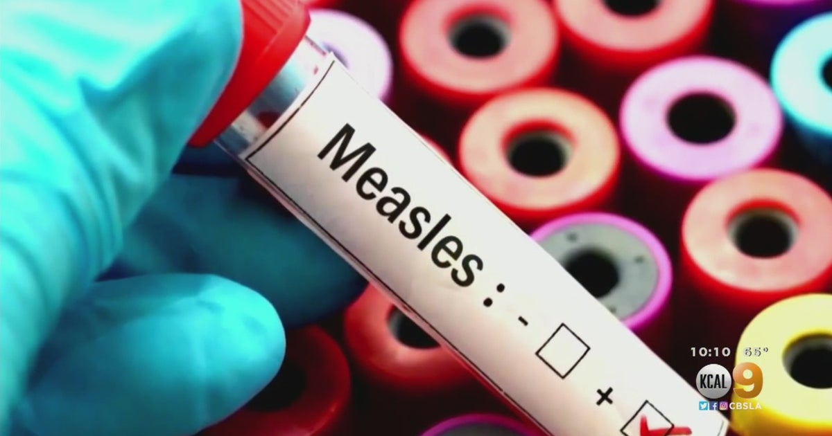 Health Dept. Warns Of Possible Measles Exposure At Bradley Terminal ...