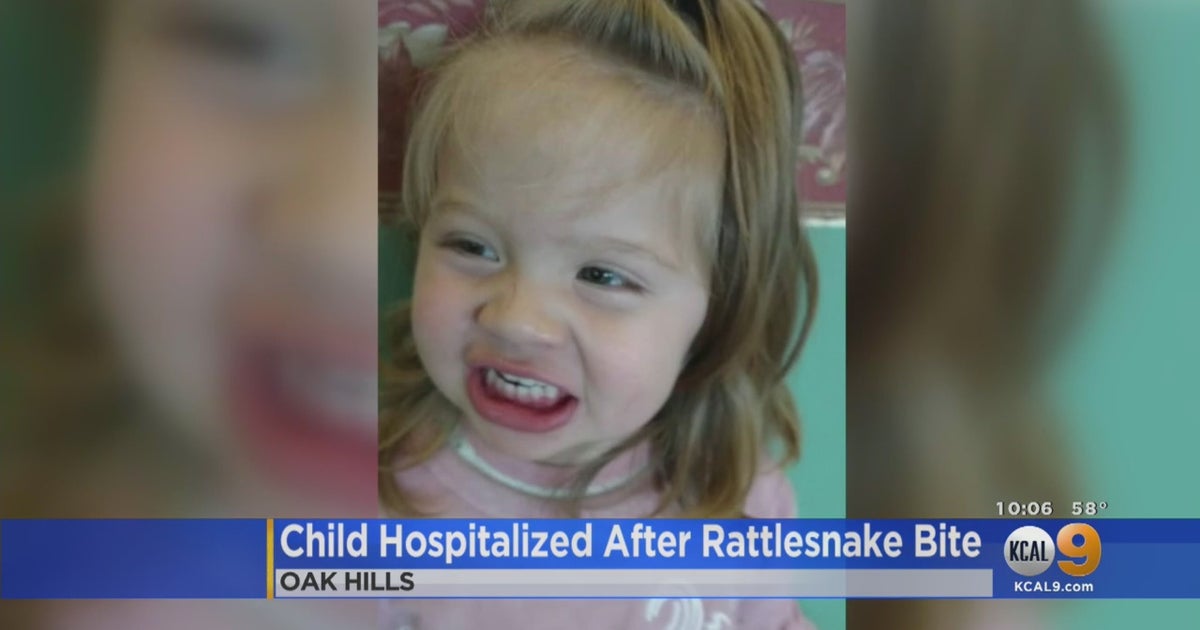 Little Girl Recovers In Hospital After Being Bitten By Rattlesnake ...