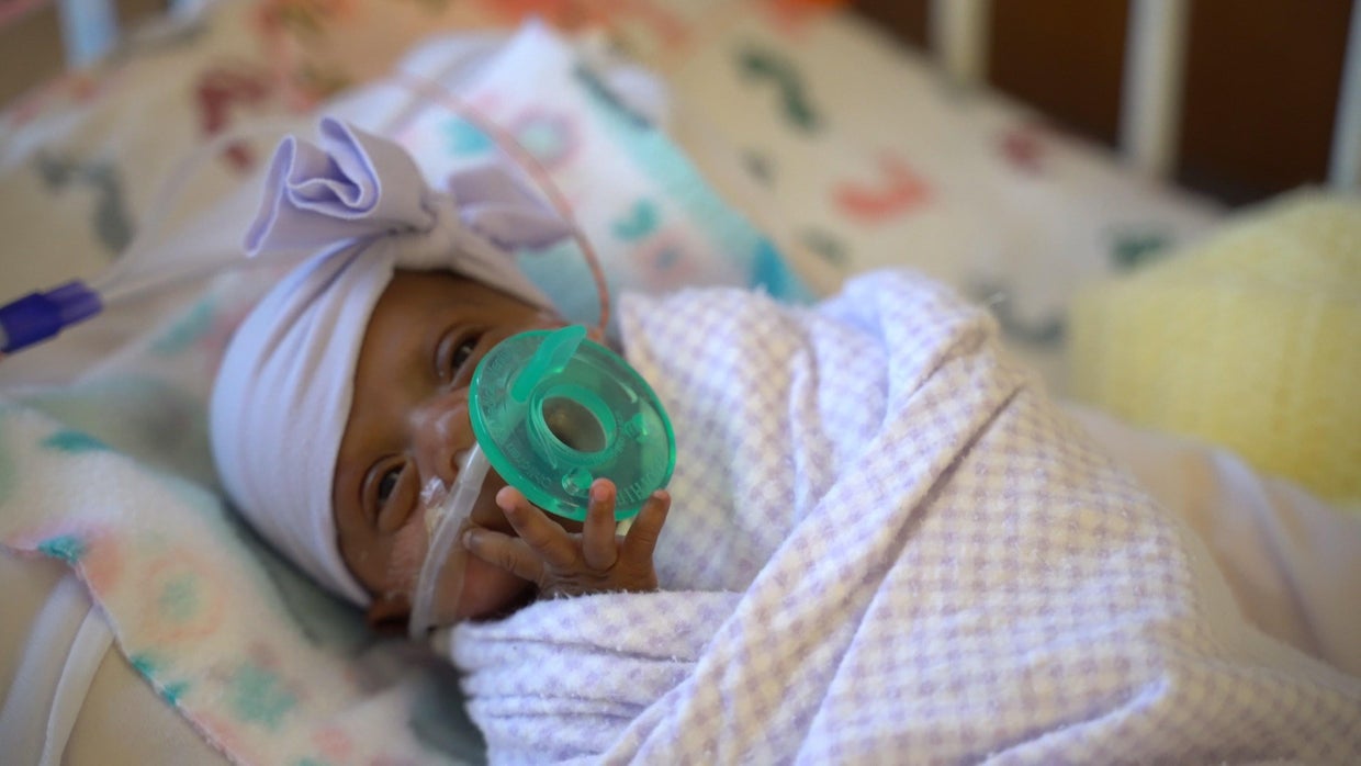Saybie: World's tiniest surviving micro-preemie newborn girl revealed ...