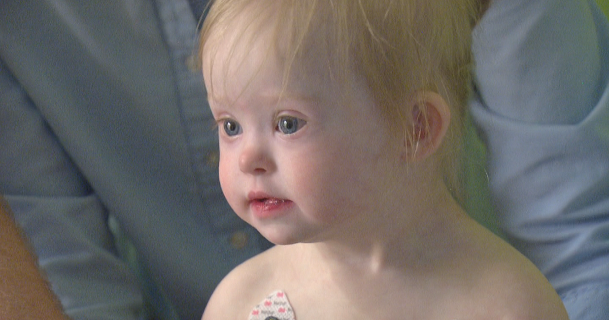 Minimally Invasive Procedure Fixes Hole In Baby's Heart: 'She's Louder ...