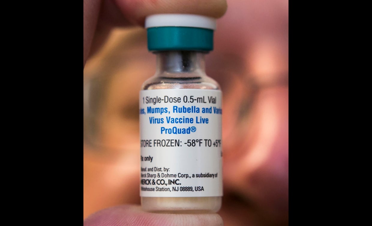 Measles outbreak: 15 facts about the measles vaccine