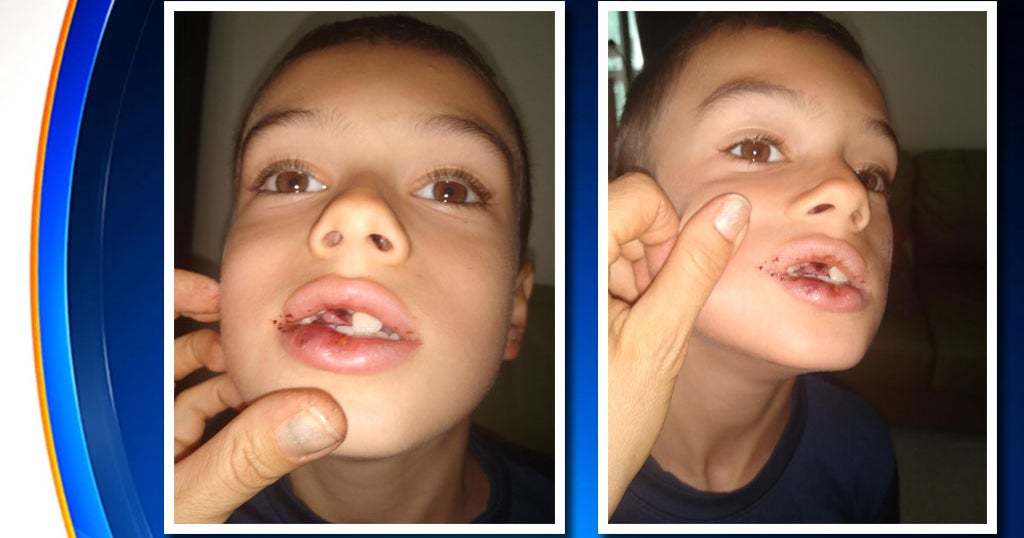 Exclusive: Homeless Man Attacks Autistic 7-Year-Old, Knocks Out Boy's ...