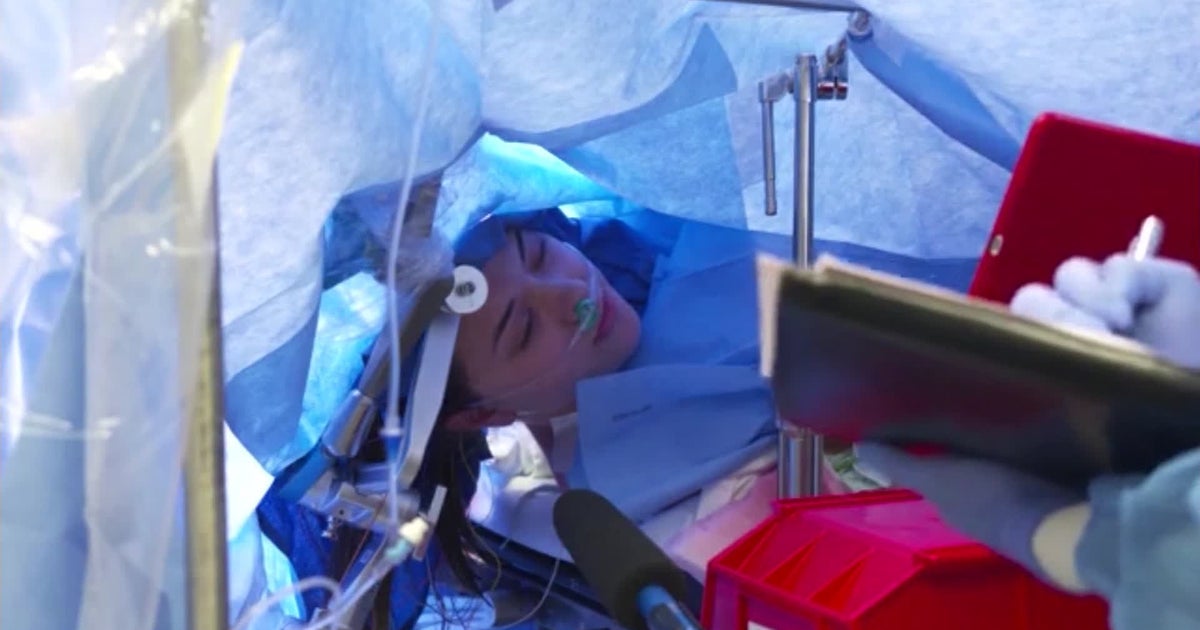 A Woman Allowed Her Brain Surgery To Be Livestreamed On Facebook. She ...