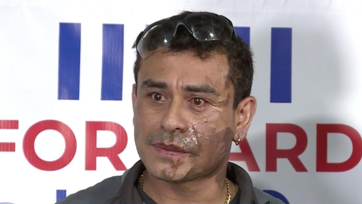 Milwaukee acid attack: Suspect in custody after Hispanic man attacked ...