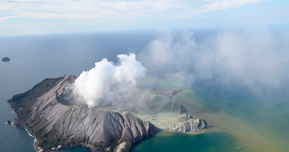 New Zealand volcano eruption: Doctors order extra skin to treat volcano ...