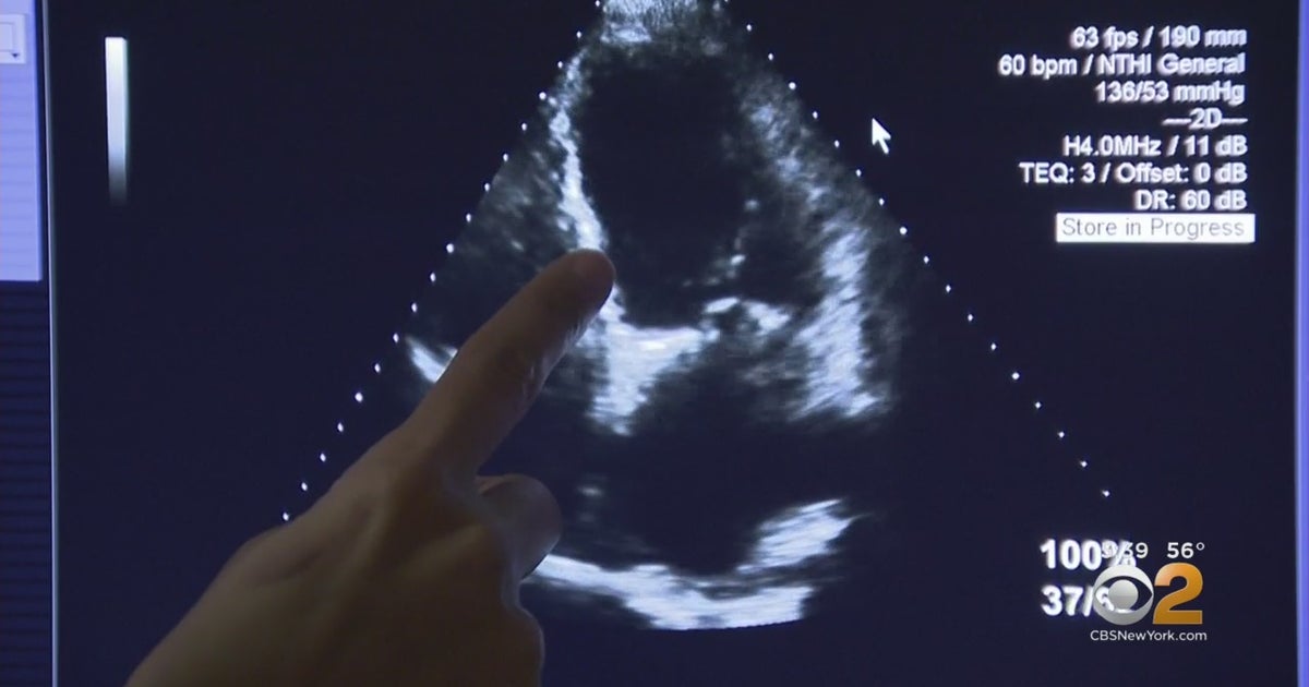 American Heart Month: Understanding The Link Between Heart Disease And ...