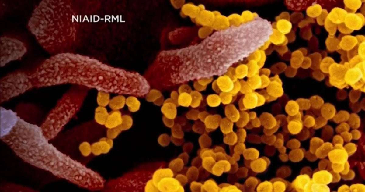 COVID-19 Testing: Who Can Get It and How? - CBS Sacramento