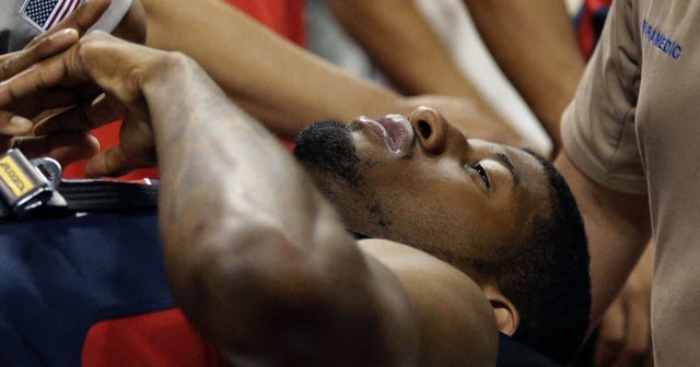 Paul George suffers horrific injury in scrimmage - CBS News