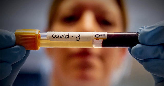 Dr. Jon LaPook on the value of antibody tests - CBS News