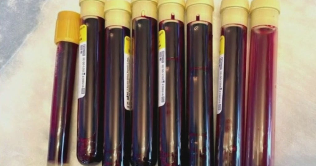Recovered Coronavirus Patient Donates Blood To Help Vaccine, Treatment ...