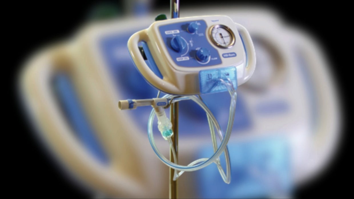 Coronavirus In Minnesota: Hillrom Adapting Respiratory Device To Treat ...