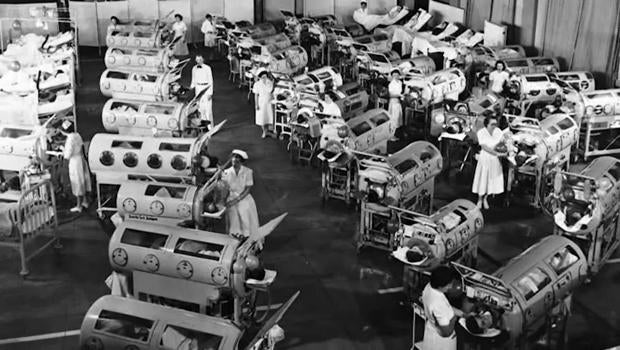 How the fight against polio was won - CBS News