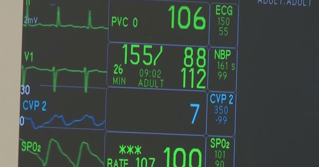 Max Minute: New Study Details Surge In New York Cardiac Arrests During ...