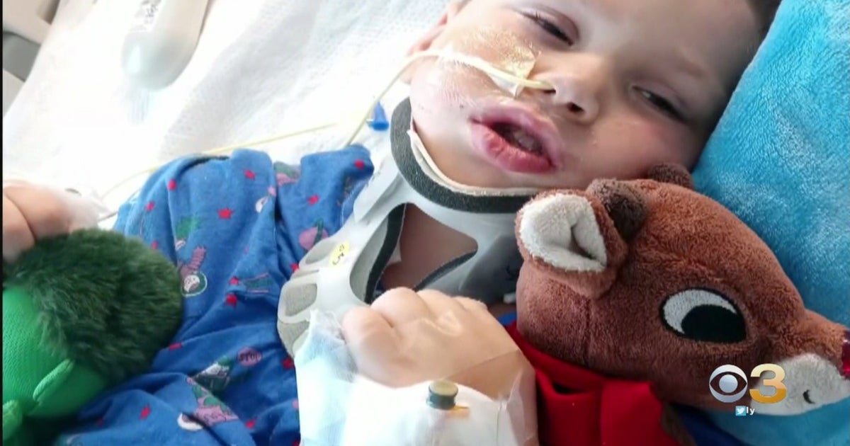 Manhunt Continues For Hit-And-Run Driver Who Critically Wounded 4-Year ...