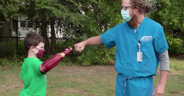 8-year-old boy receives bionic "Hero Arm" - CBS News