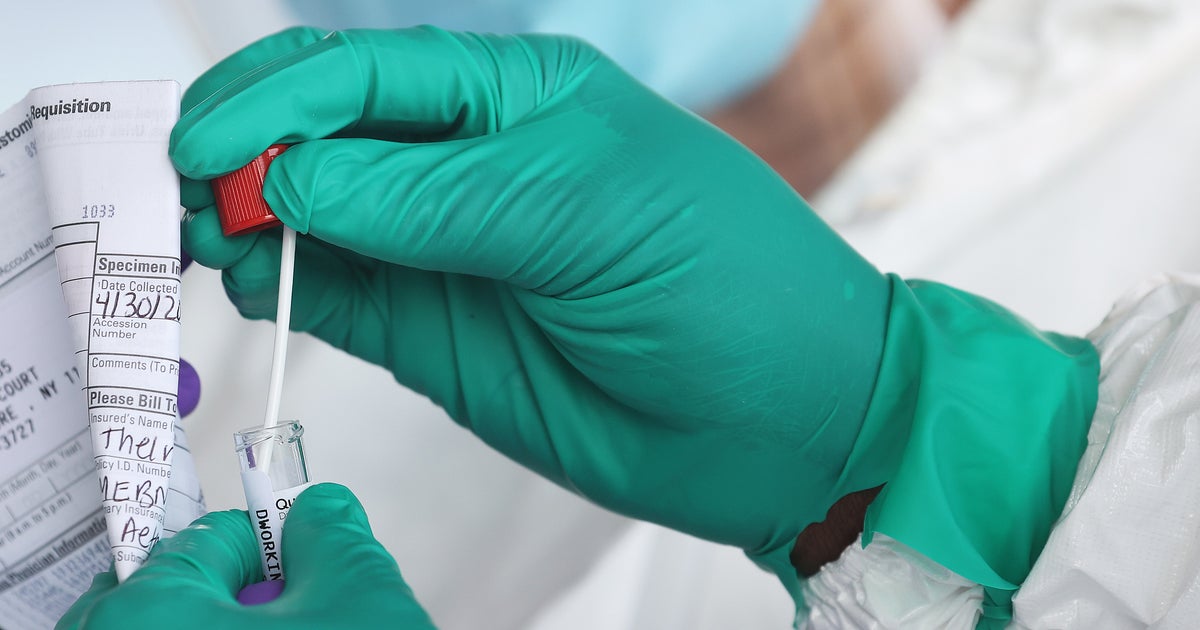 First Case Of Brazil Variant Of COVID-19 Confirmed In Illinois - CBS ...