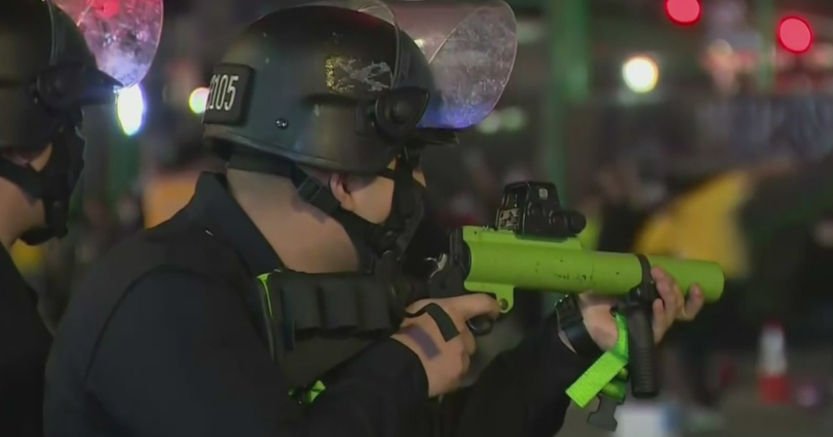 Serious Injuries Prompt Renewed Calls From State Assembly Leaders To ...