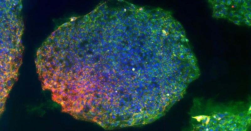 Prop 14 Stem Cell Research Funds For CA Institute For Regenerative ...
