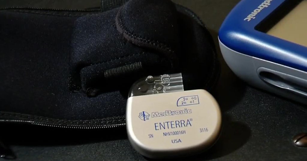 Doctor Shares Hidden Dangers Of iPhone 12 For People With Pacemakers ...