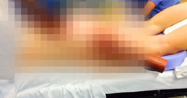 Texting driver impaled by pole - CBS News