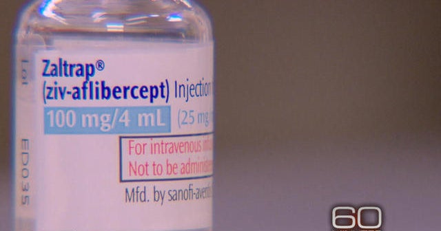 Doctors fight against rising cost of cancer drugs - CBS News