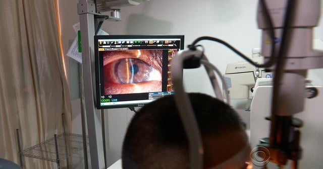 Scientists working on restoring human sight with pig eyes - CBS News