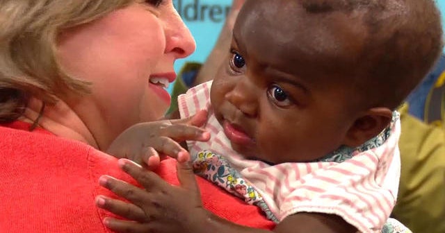 Surgery for baby born with two extra legs - CBS News