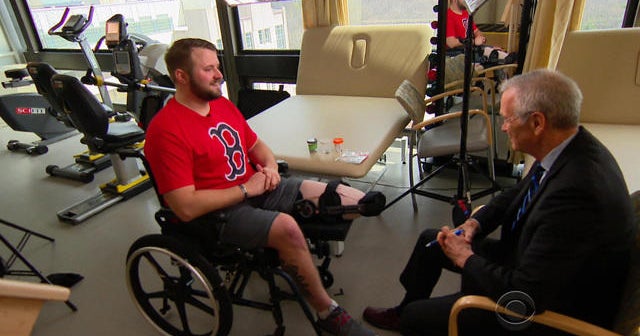 Veteran with severe leg injuries undergoes advanced amputation - CBS News