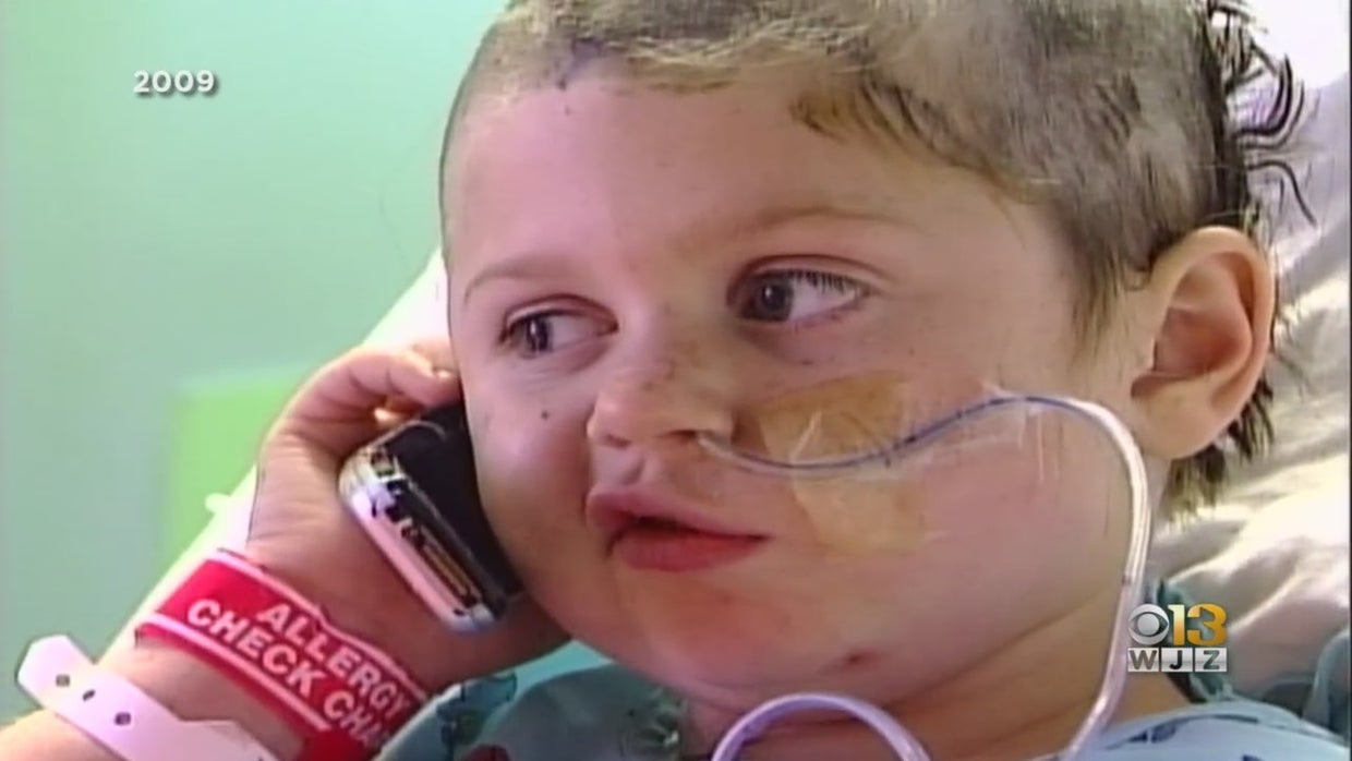 A Medical Miracle: 12 Years After Half Of Her Brain Was Removed, Jessie ...