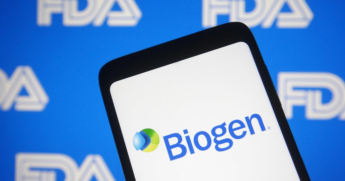 Biogen's new Alzheimer's drug comes with "serious cost concerns" for ...