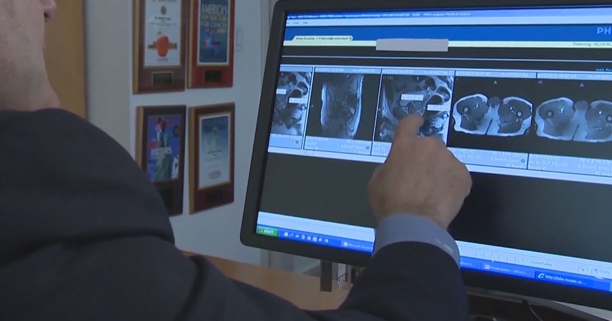 'Don't Put It Off Any Longer': Colorado Doctor Urges Prostate Cancer ...