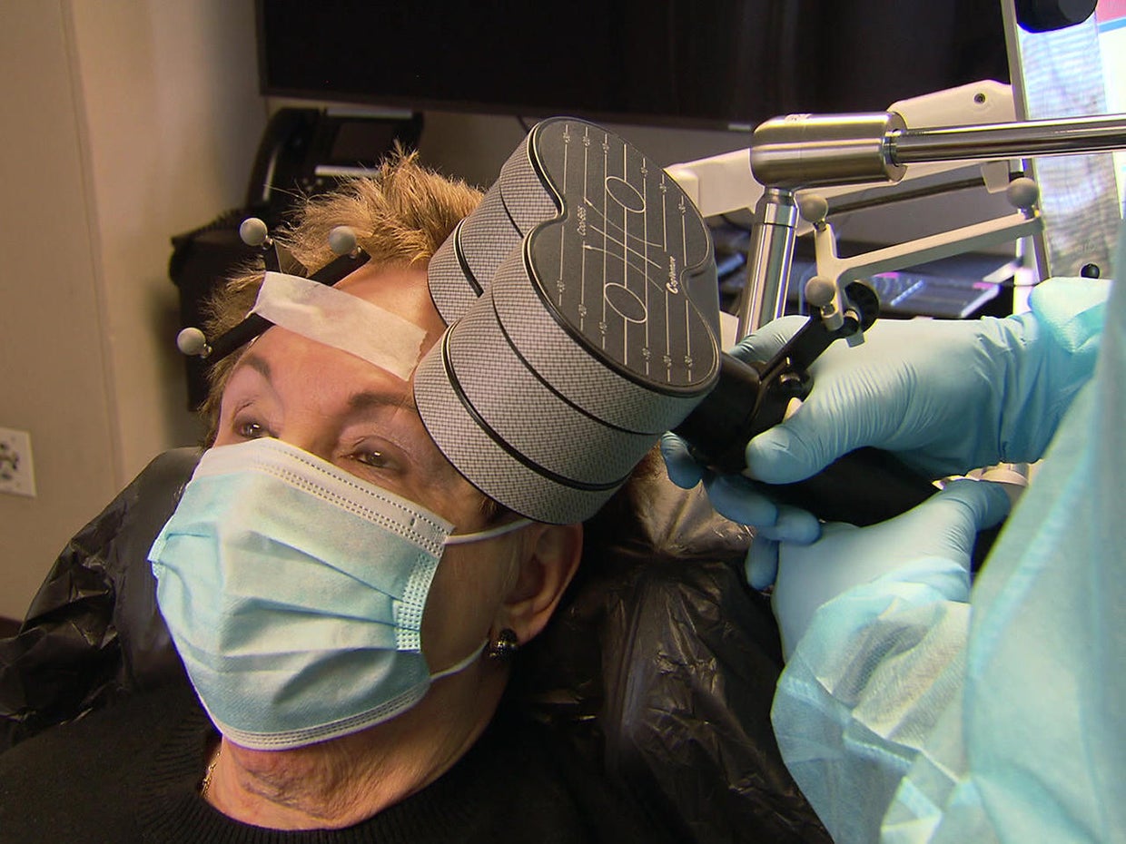 SAINT: Hope for new treatment of depression - CBS News