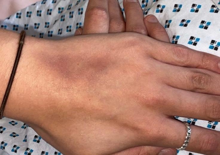 Man charged over mystery needle attacks in France - CBS News