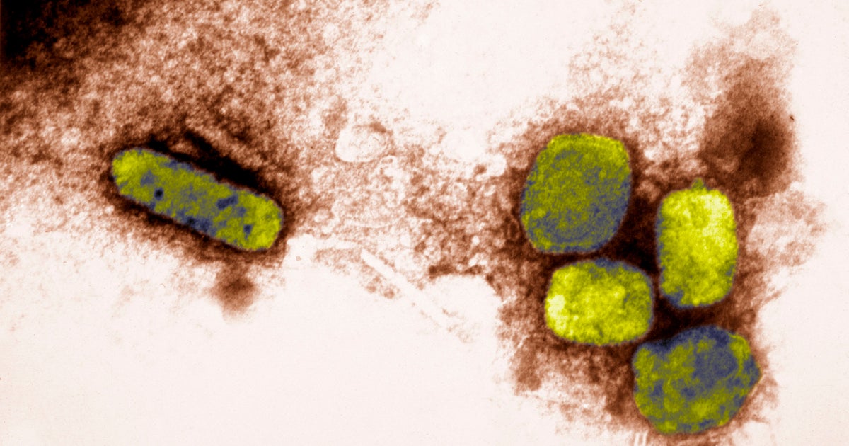 Vials Labeled 'Smallpox' Found At Vaccine Research Facility In ...