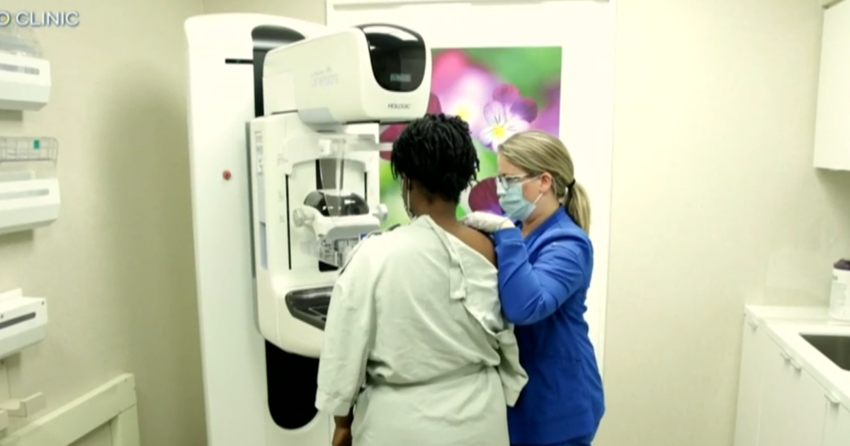 Tackling the racial divide in the fight against cancer - CBS News
