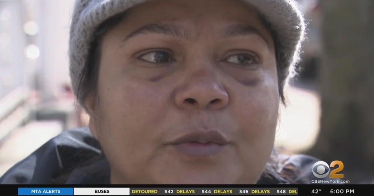 Queens Woman Attacked In Bed During Home Invasion - CBS New York