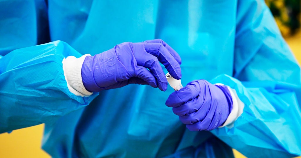 COVID In Minnesota: MDH Reports 356 Cases, 11 Deaths - CBS Minnesota