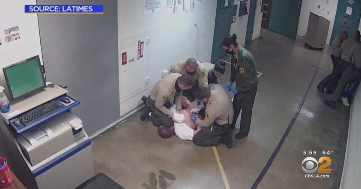 Sheriff investigating why supervisors didn't inform him of deputy neck ...