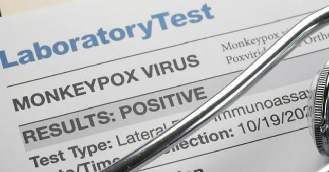 Monkeypox cases spreading worldwide - CBS News