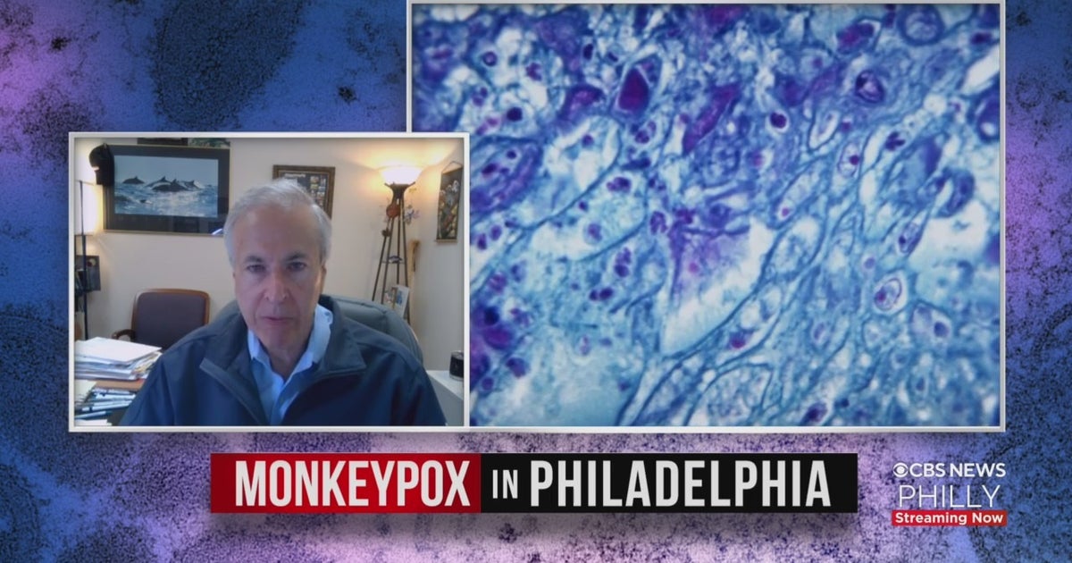 VIDEO: Jefferson Health's Dr. Rob Danoff Discusses Monkeypox After ...