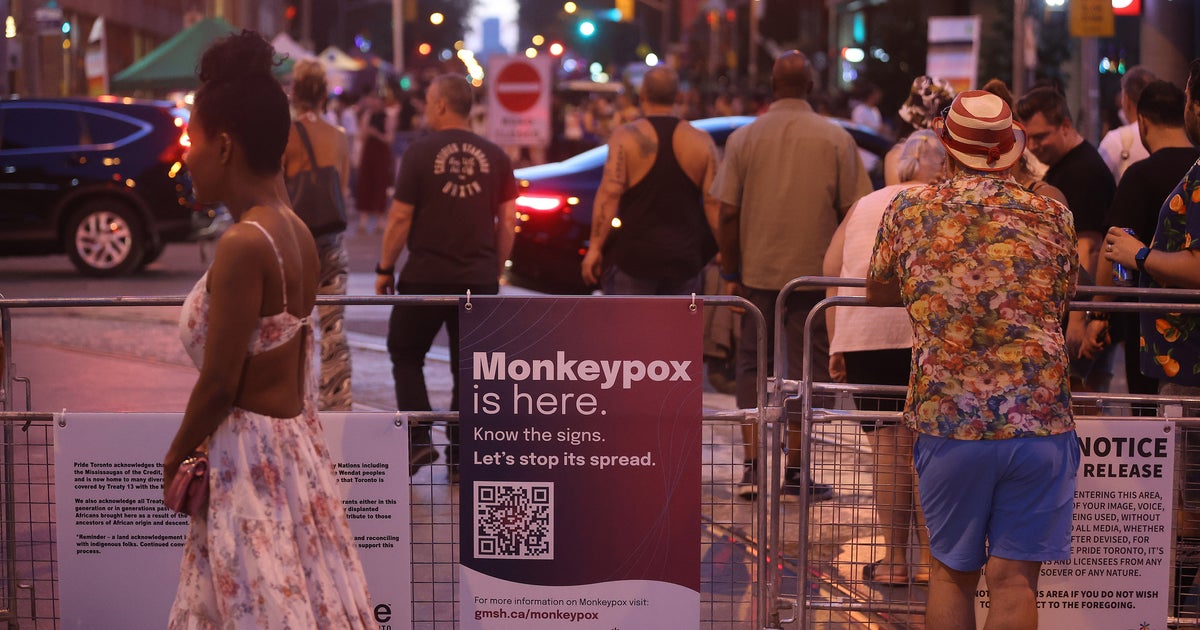WHO Says Monkeypox Is Not An International Public Health Emergency, But ...