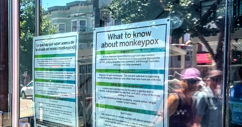 Bay Area LGBT community frustrated by response to monkeypox outbreak ...