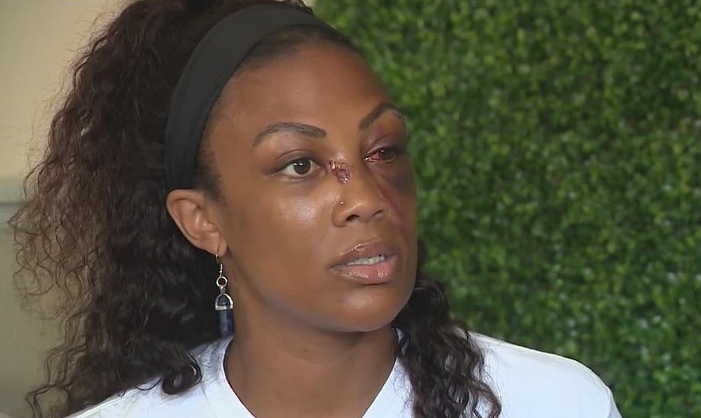 "Rage in his eyes": Former Olympian Kim Glass recovering from attack by ...