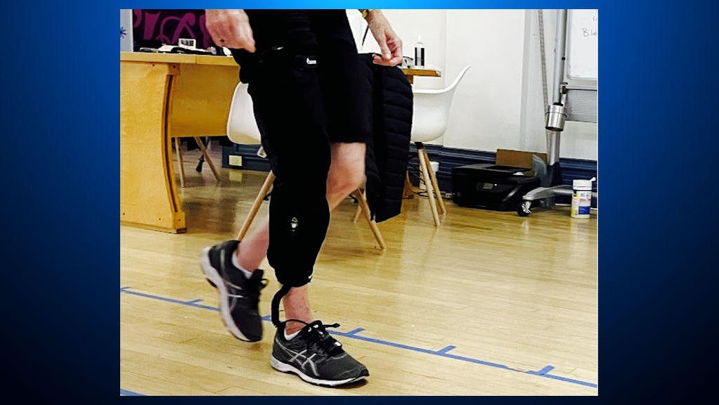 Neural sleeve developed in Bay Area helping patients walk again - CBS ...