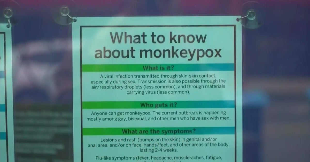 Organizers focus on monkeypox prevention ahead of Market Days - CBS Chicago