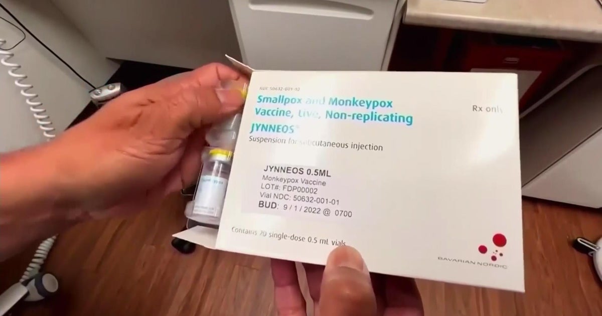 Chicago outlines public health plan for monkeypox - CBS Chicago