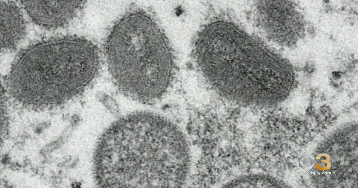 Monkeypox declared public health emergency by US health officials - CBS ...