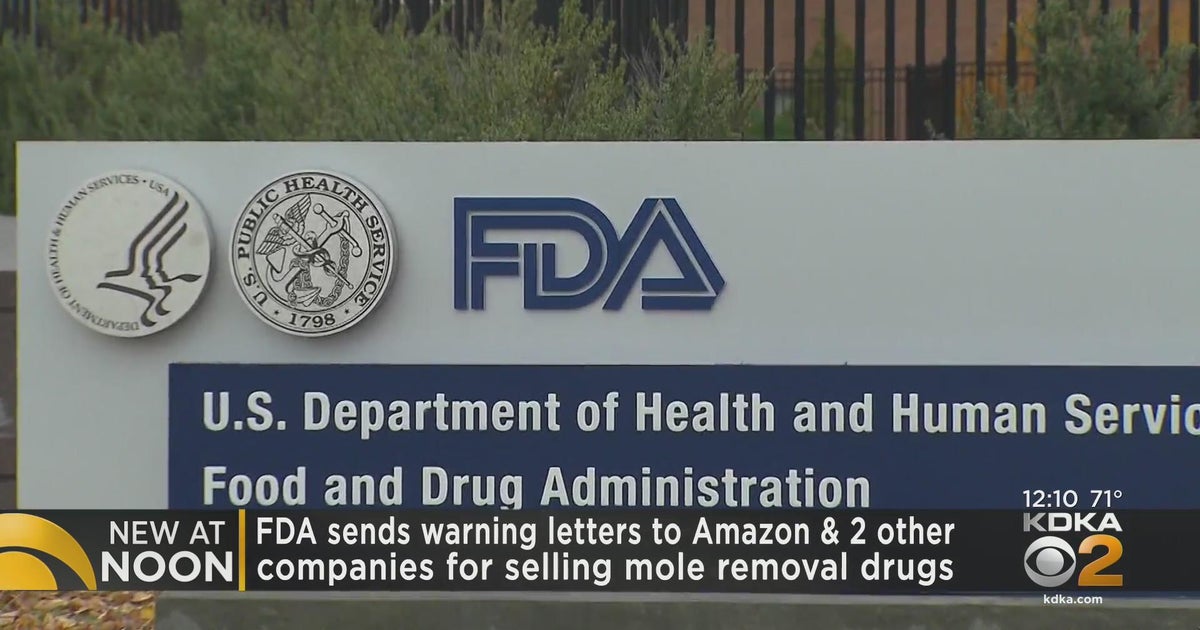 FDA issues warning over mole removal drugs - CBS Pittsburgh